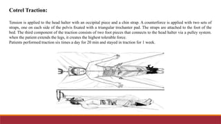 Pathomechanics of Scoliosis and principles of management of scoliosis .pptx