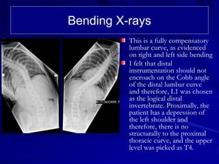 Case Review #13: 13 year old female softball player with Adolescent ...