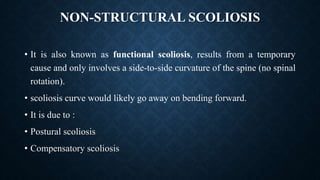 SCOLIOSIS (1).pptx
