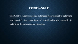 SCOLIOSIS (1).pptx