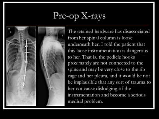 Case Review #50: 29 year old woman presents with dislodged ...
