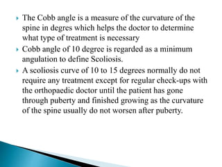Scoliosis and cobb angle | PPTX