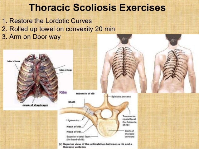 Scoliosis correction