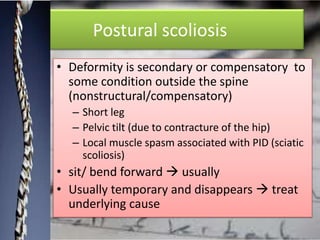 Scoliosis | PPTX