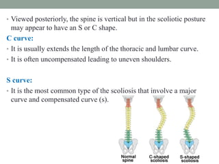 Scoliosis part 1.pdf.pdfvvxcvhnhchxgxyxgxycyc | PDF