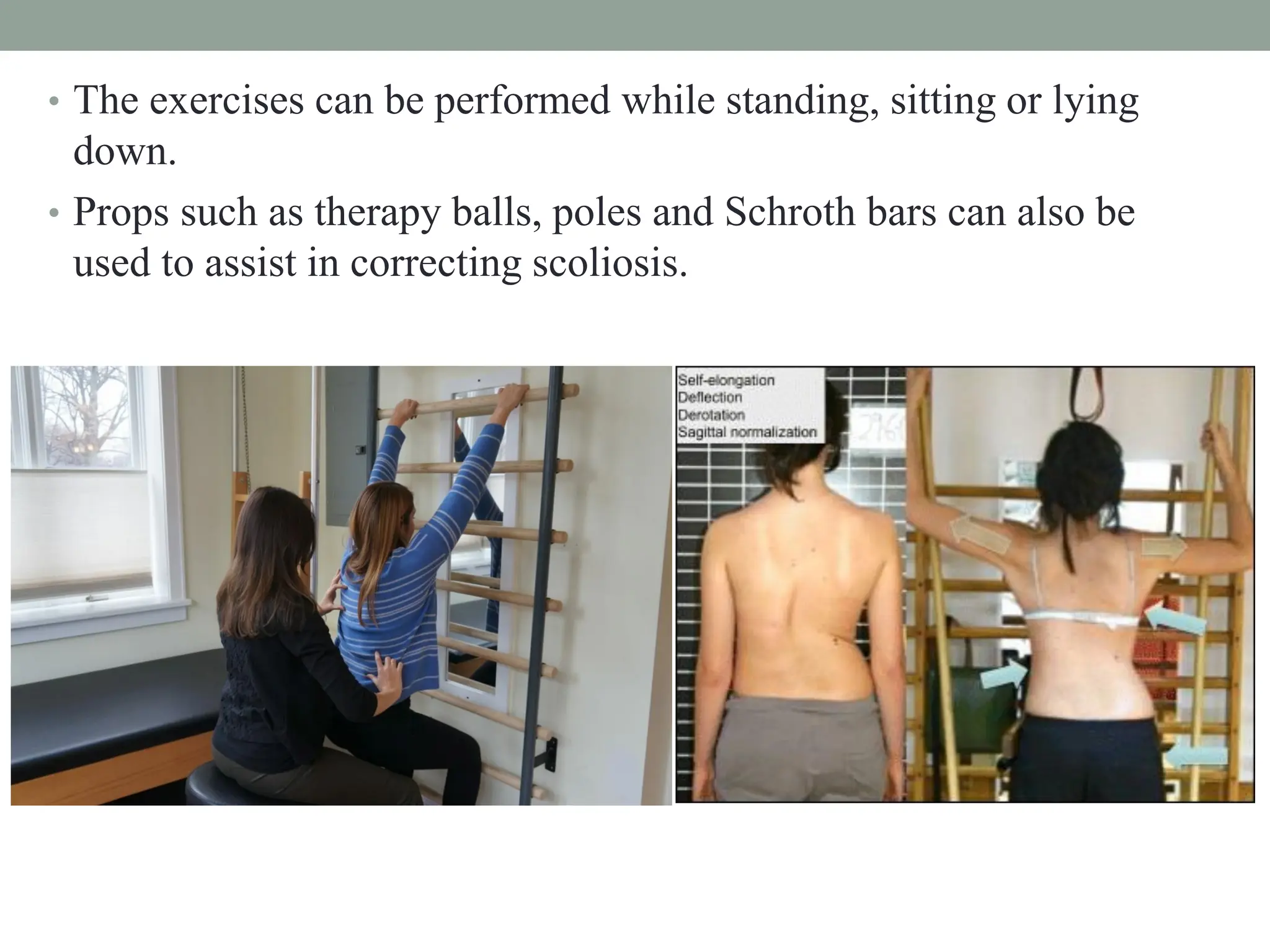 Scoliosis part 2.pdf.pdftdgzzhxjvivjvicuch | PDF