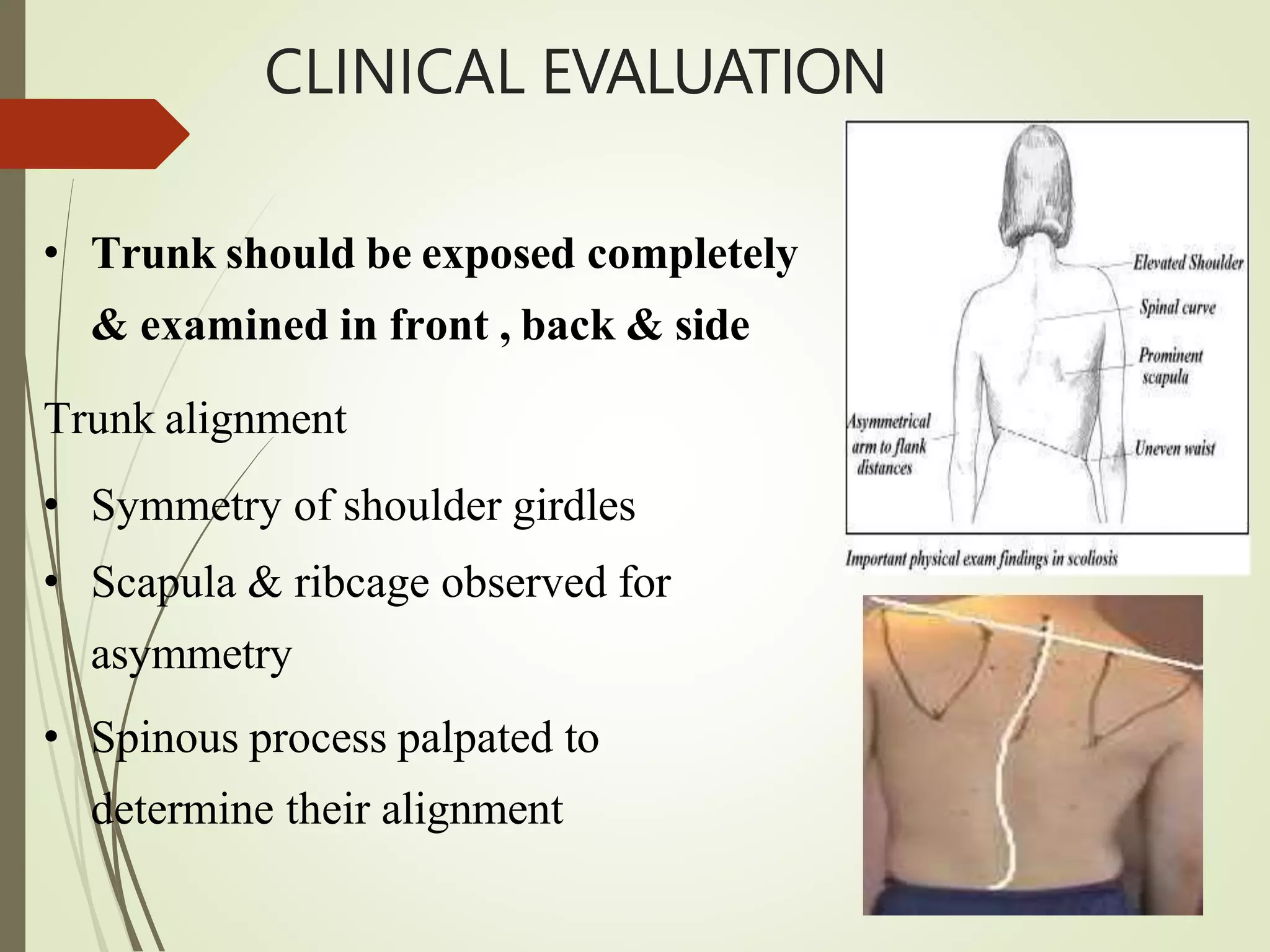 scoliosis ppt.pptx