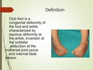 scoliosis ppt.pptx