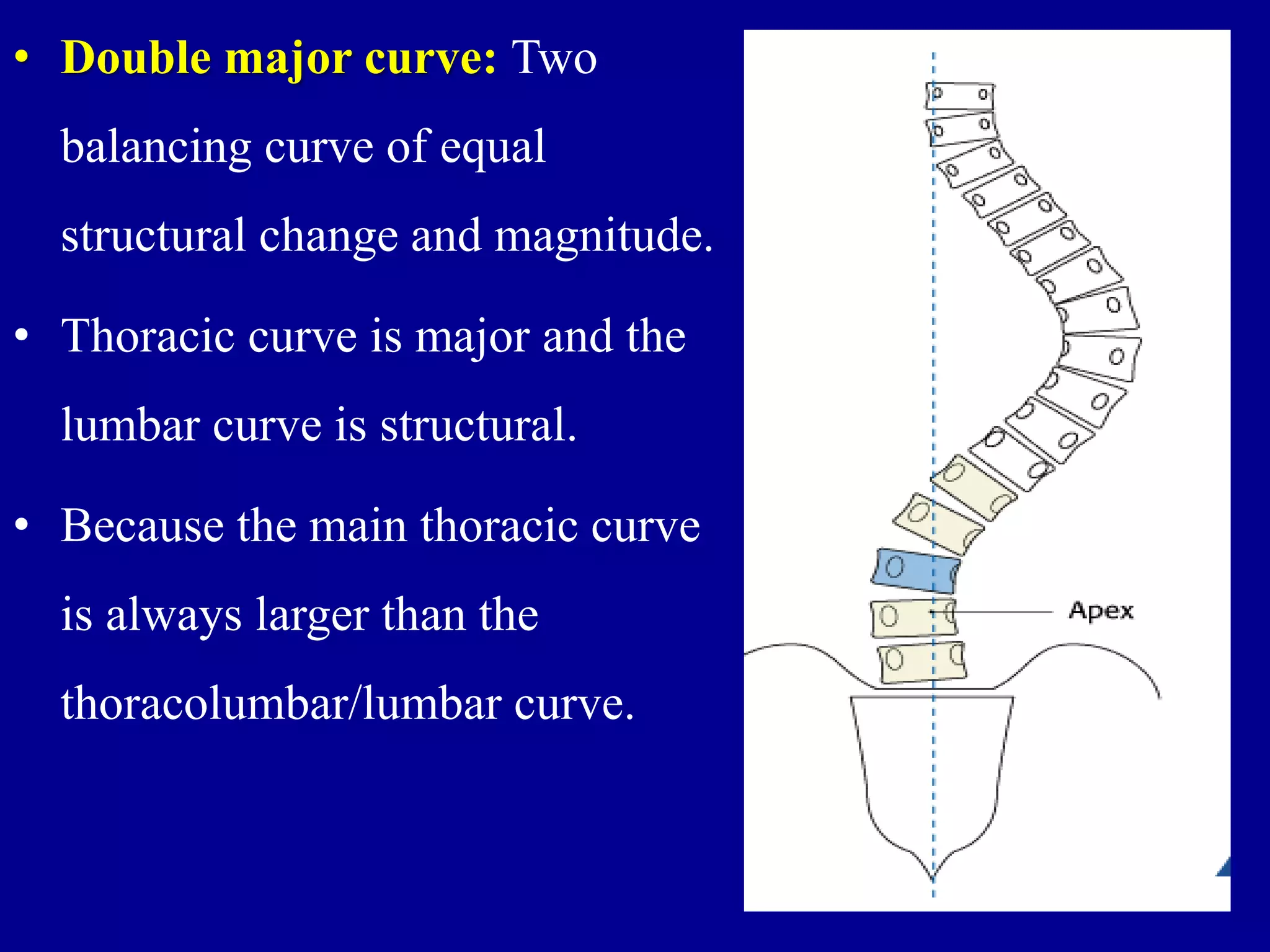 Scoliosis | PPTX