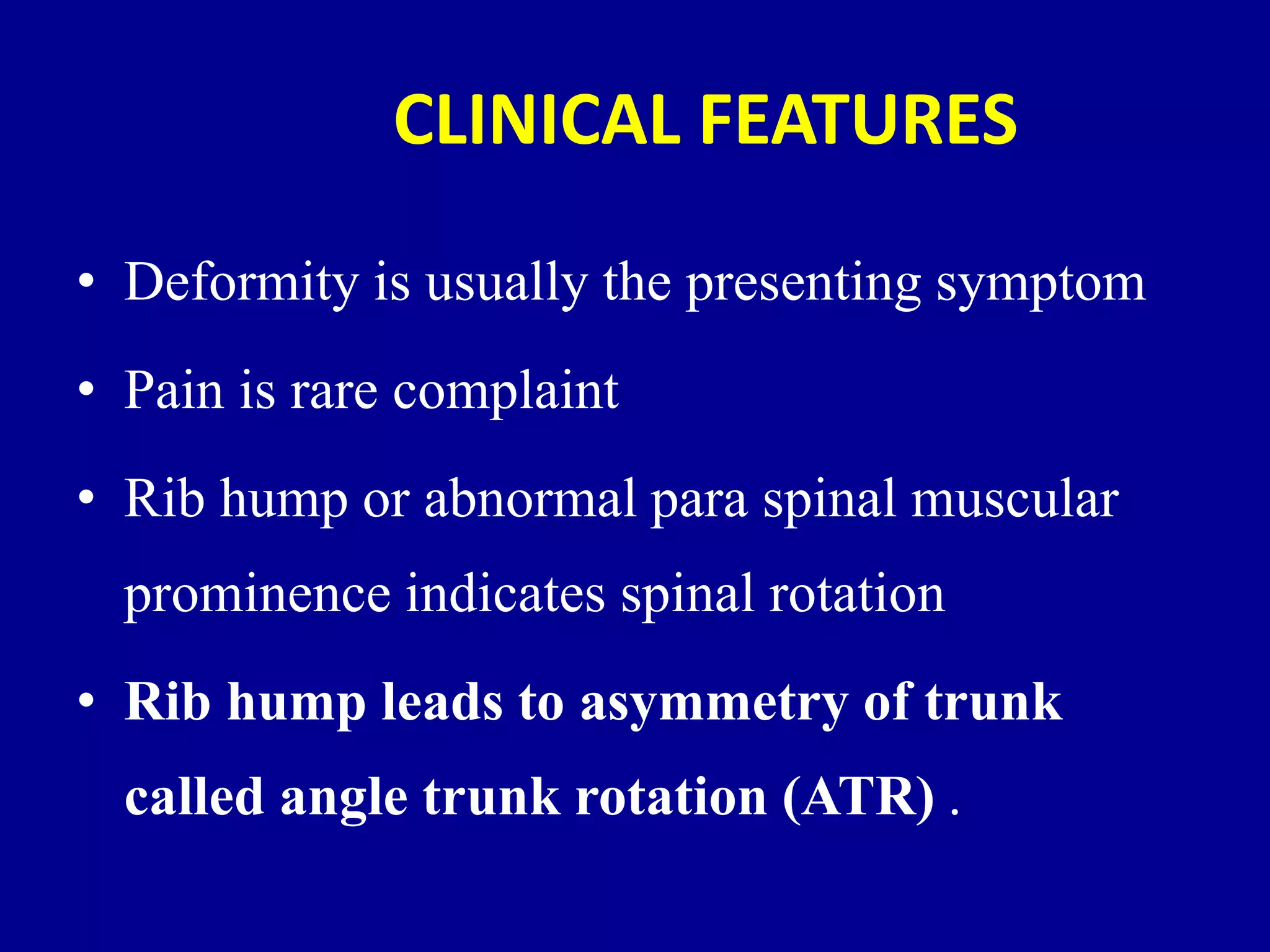 Scoliosis | PPTX
