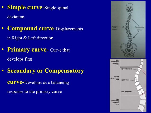 Scoliosis | PPTX
