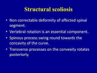 Scoliosis | PPTX