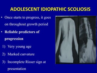 Risser Cast Scoliosis