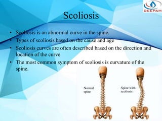 Scoliosis Treatment in India | PPTX | Bone and Joint Conditions ...