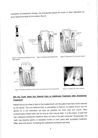 Scope-of-endodontics in dentistry required by dentists as we know the ...