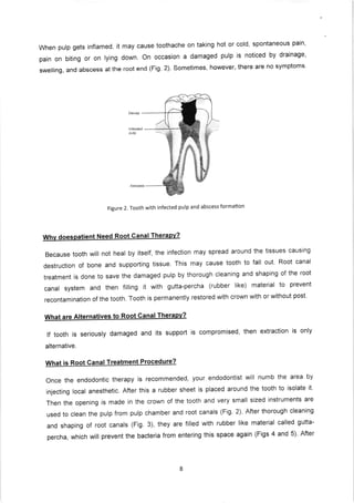 Scope-of-endodontics in dentistry required by dentists as we know the ...