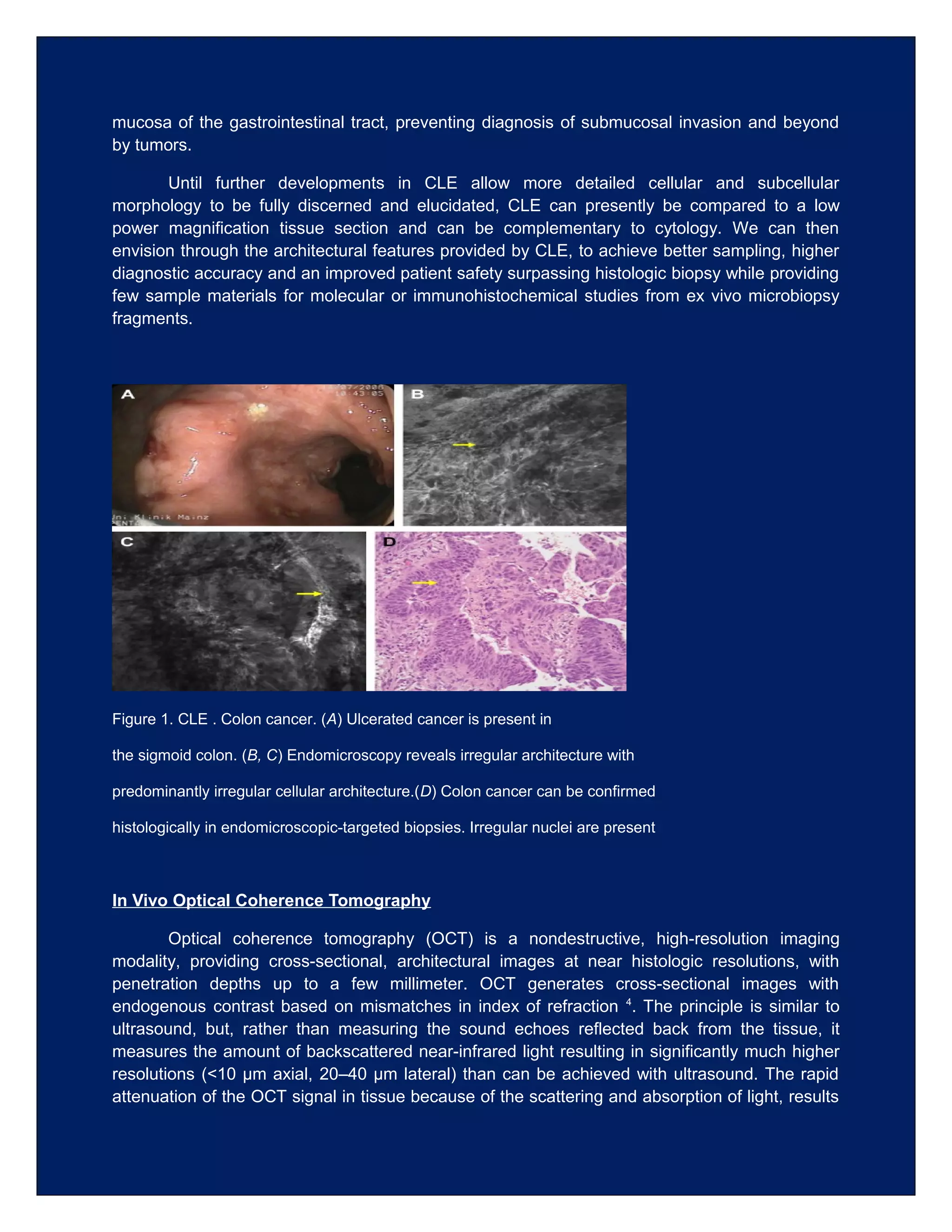 Confocal Laser Endomicroscopy and In Vivo Optical Coherence Tomography ...