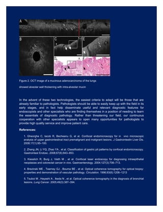 Confocal Laser Endomicroscopy and In Vivo Optical Coherence Tomography | PDF