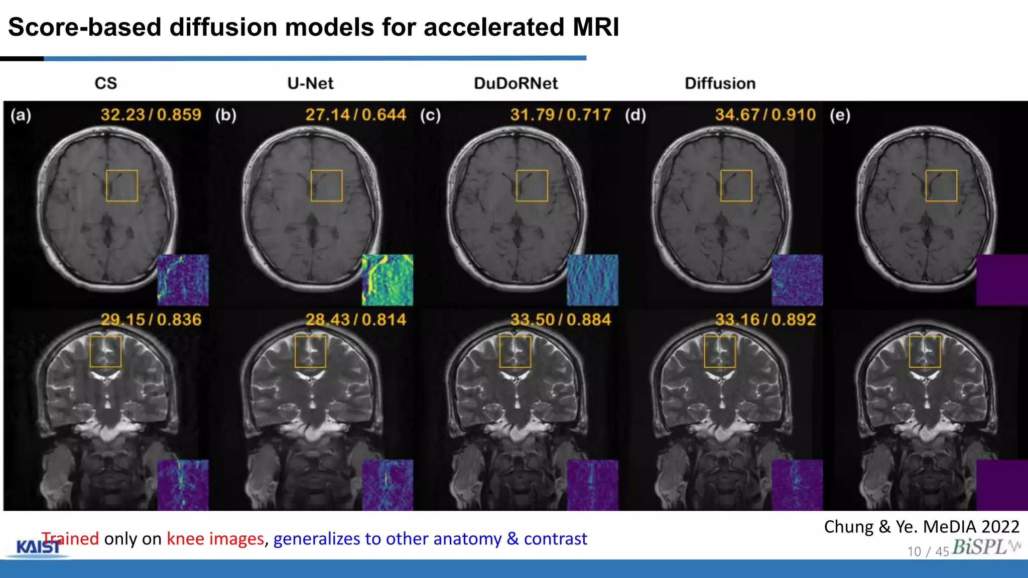 Score-based diffusion models for accelerated MRI.pptx