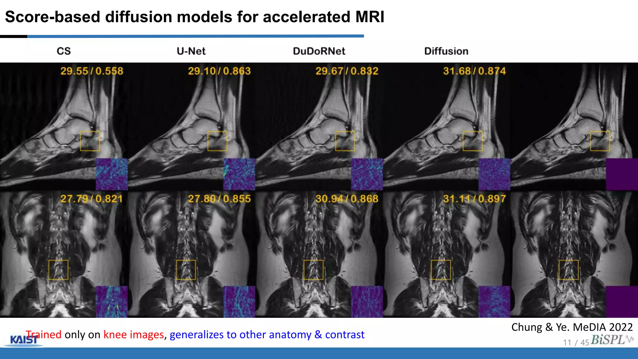 Score-based diffusion models for accelerated MRI.pptx