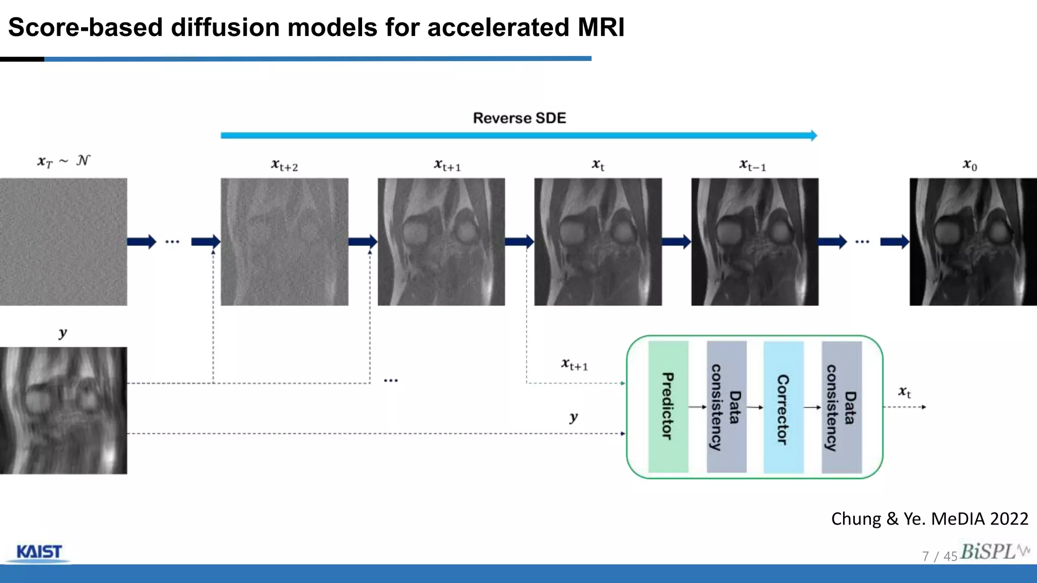 Score-based diffusion models for accelerated MRI.pptx