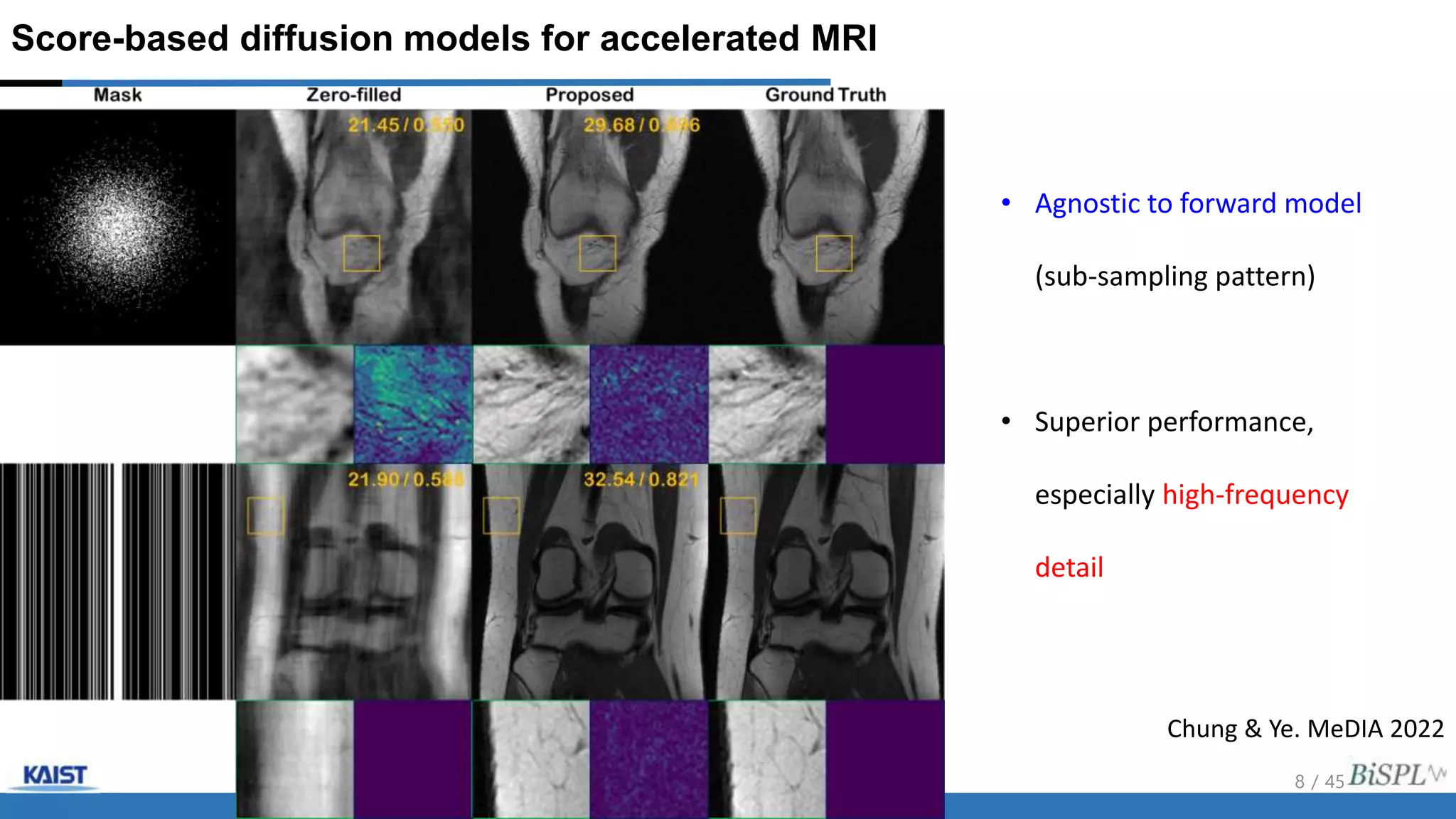 Score-based diffusion models for accelerated MRI.pptx