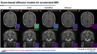 Score-based diffusion models for accelerated MRI.pptx