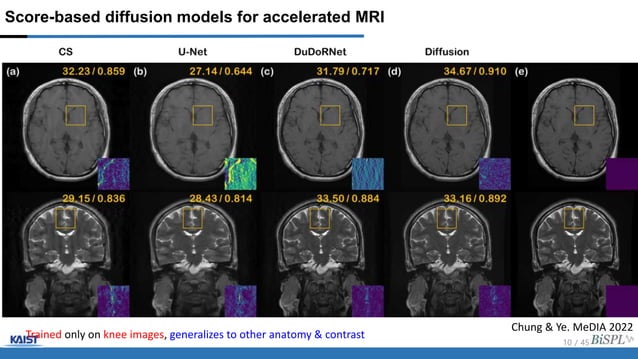 Score-based diffusion models for accelerated MRI.pptx