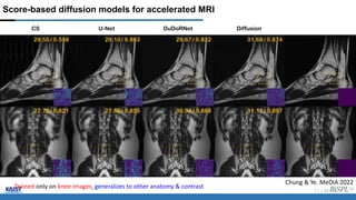 Score-based diffusion models for accelerated MRI.pptx