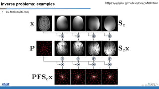 Score-based diffusion models for accelerated MRI.pptx