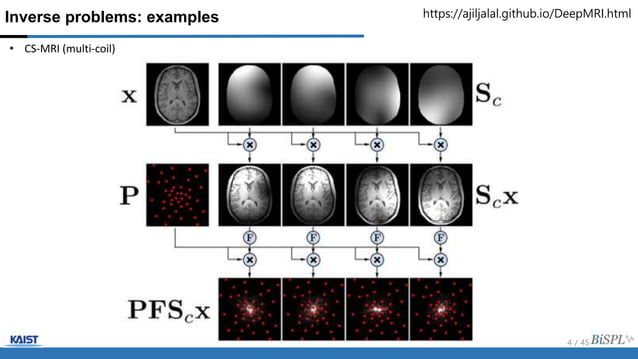 Score Based Diffusion Models For Accelerated Mri Pptx