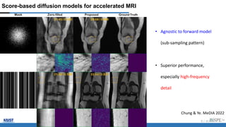 Score-based diffusion models for accelerated MRI.pptx