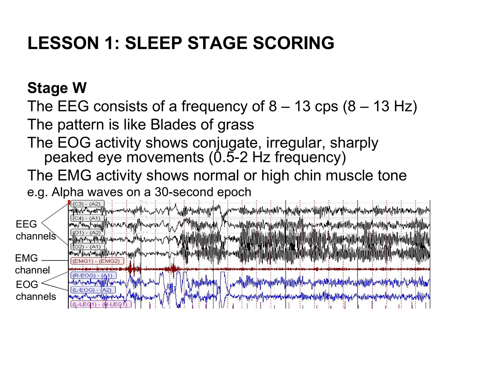 Scoring sleep 2013 webinar n2sleep | PDF