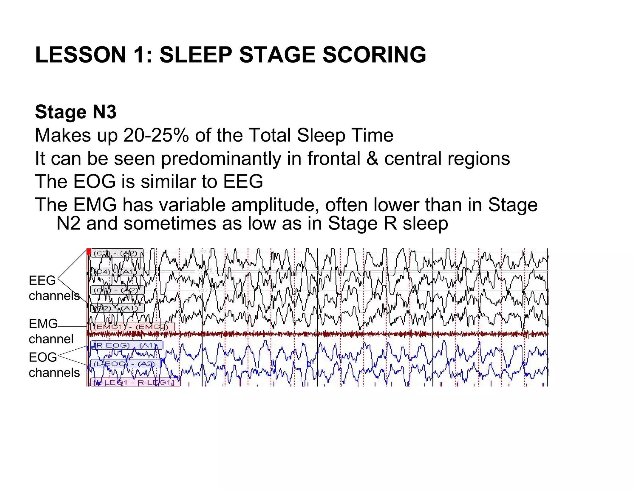 Scoring sleep 2013 webinar n2sleep | PDF