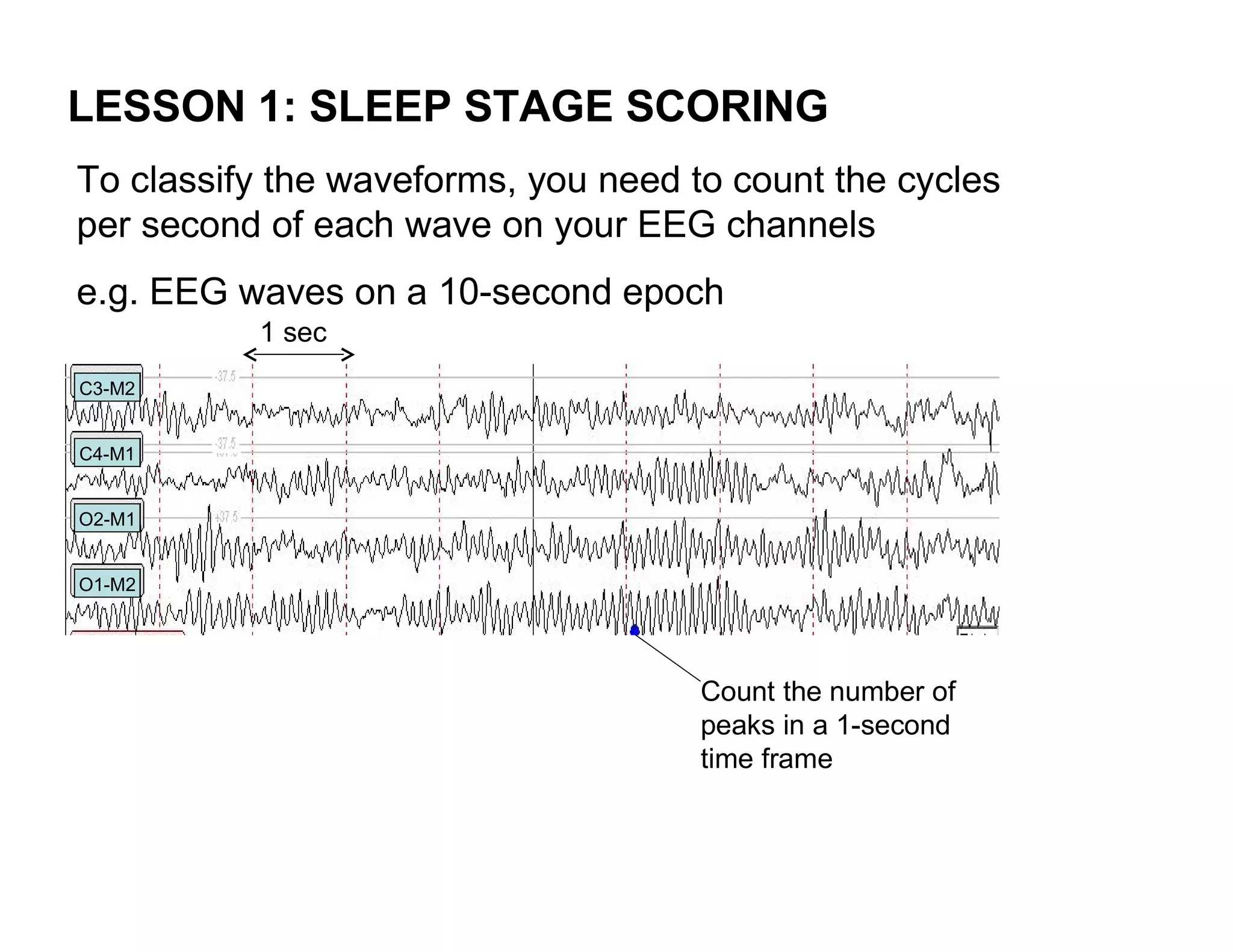 Scoring sleep 2013 webinar n2sleep | PDF | Sleep Disorders | Diseases ...