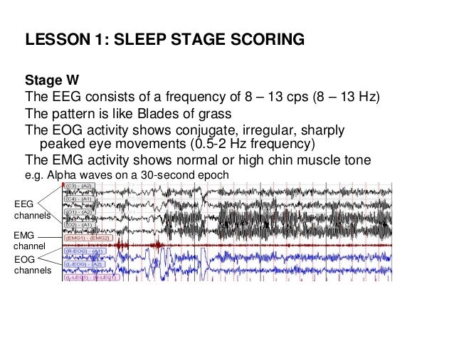 Scoring sleep 2013 webinar n2sleep
