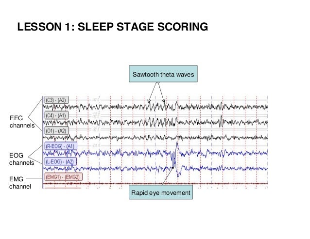 Scoring sleep 2013 webinar n2sleep