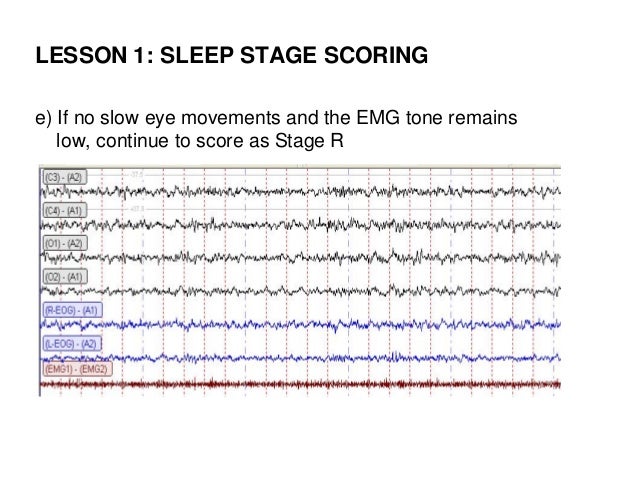 Scoring sleep 2013 webinar n2sleep