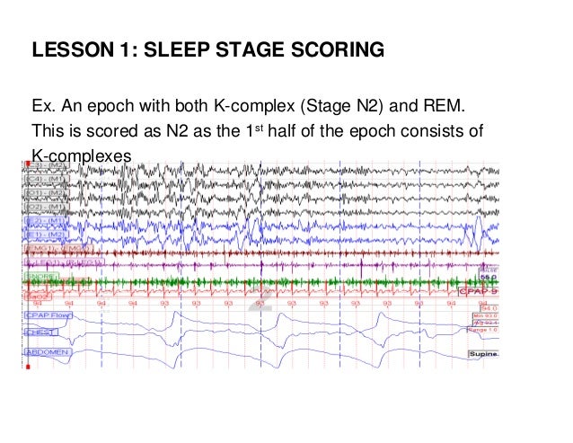 Scoring sleep 2013 webinar n2sleep