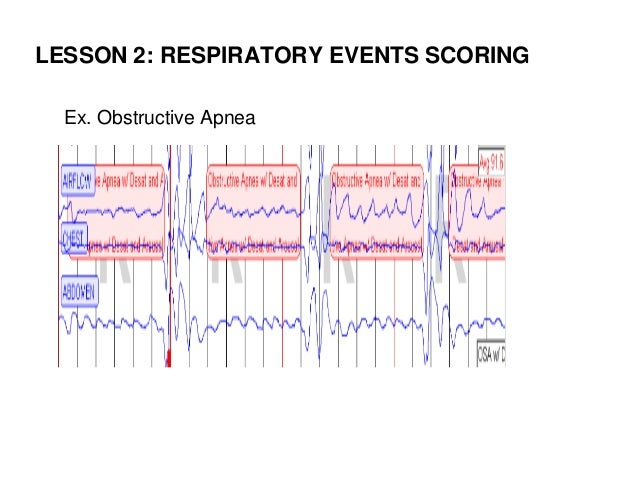 Scoring sleep 2013 webinar n2sleep