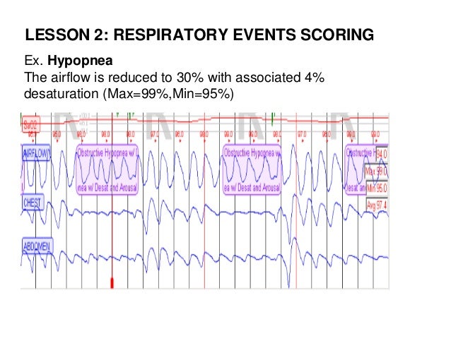 Scoring sleep 2013 webinar n2sleep