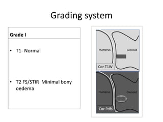 Bone Response to Suture Anchor Classification Training Document | PPT