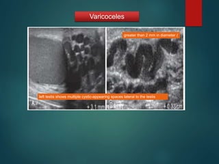 Scortal Ultrasound | PPTX