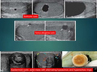 Scortal Ultrasound | PPTX