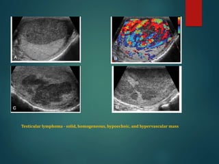 Scortal Ultrasound | PPT