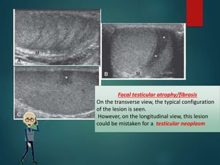 Scortal Ultrasound | PPTX
