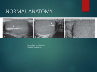 Scortal Ultrasound | PPTX