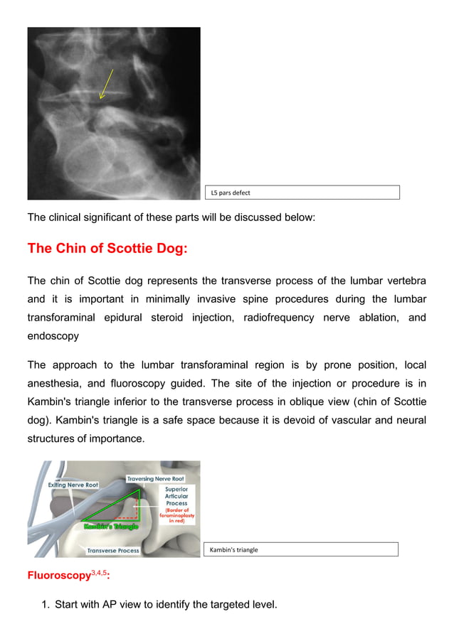Scottie Dog Sign.pdf | Brain and Nervous System Disorders | Diseases ...