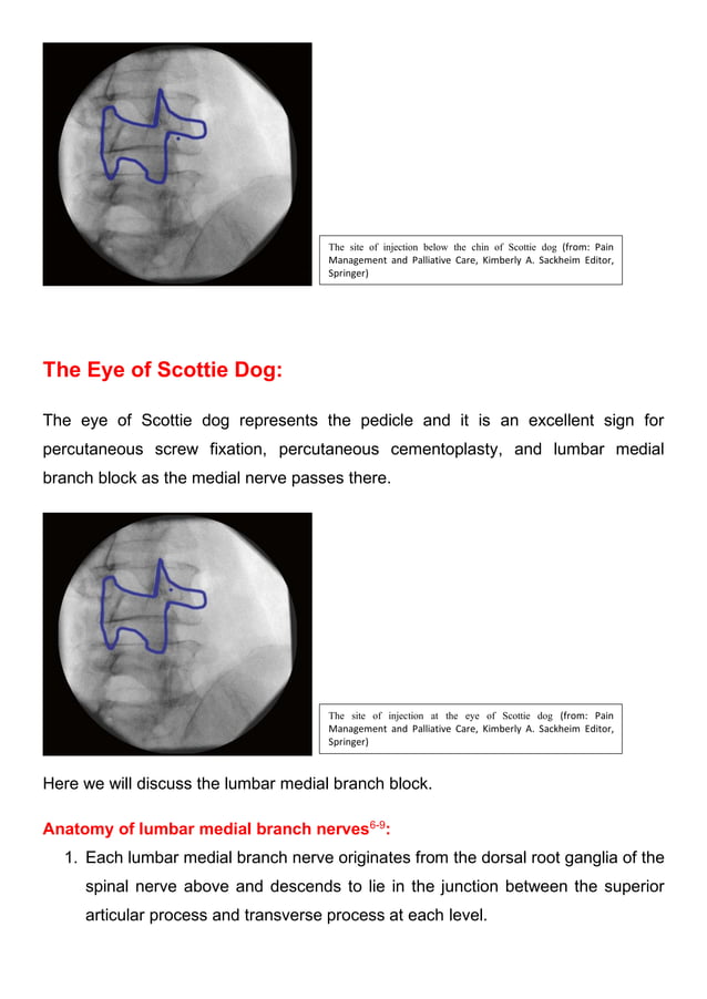 Scottie Dog Sign.pdf | Brain and Nervous System Disorders | Diseases ...