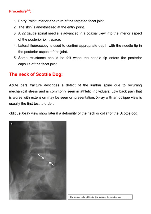 Scottie Dog Sign.pdf | Brain and Nervous System Disorders | Diseases ...
